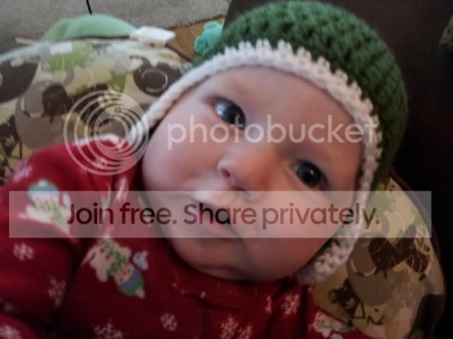 Microform cleft lip - BabyCenter